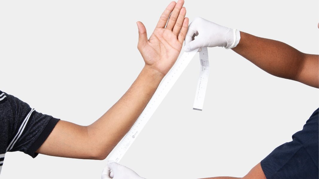 Short Arm Immobilizer - OrthoHeal